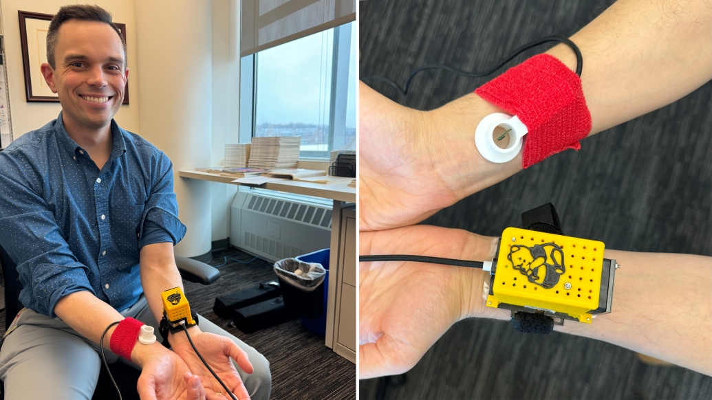 Novel measuring tool reduces severe allergic reactions during food ...