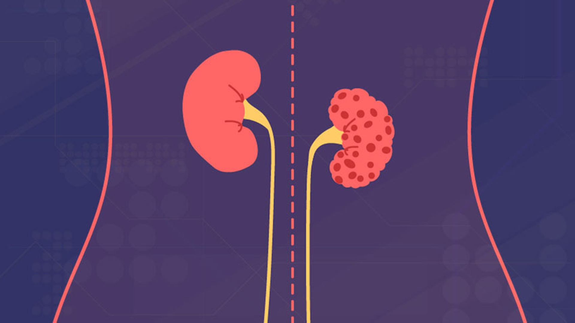 New Protein Target Could Lead to Breakthrough in Kidney Injury Prevention