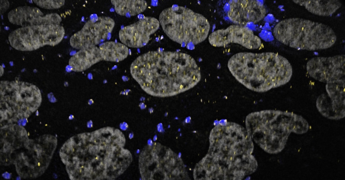 Researchers determine how cells prevent RNA traffic jams under stress ...