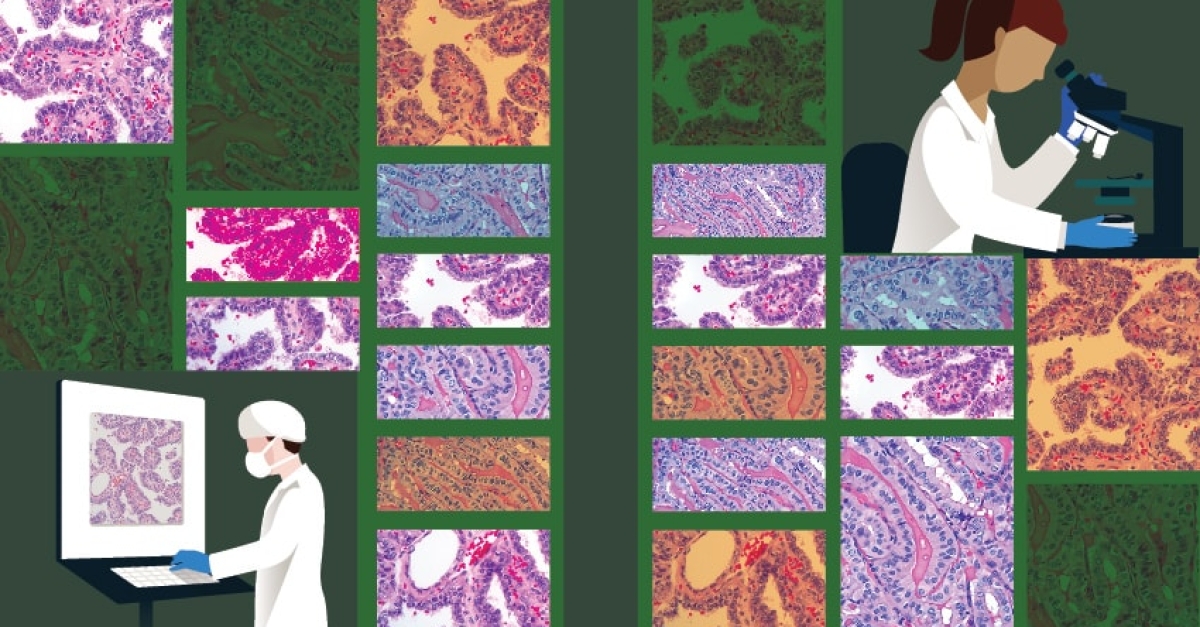 How The Cancer Genome Atlas Will Shape the Future of Cancer Research